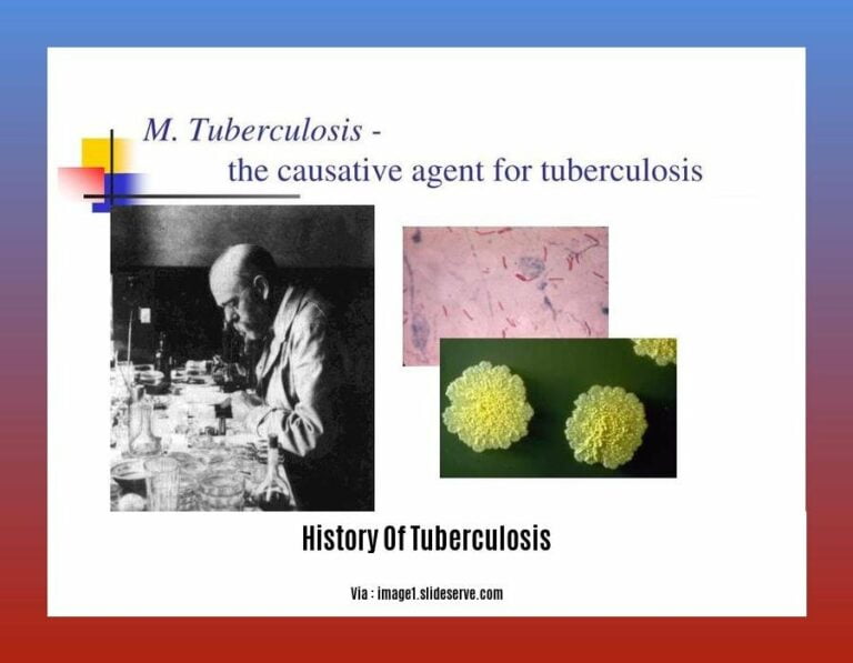 - The History of Tuberculosis: An Exploration of a Disease That Has ...