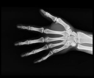 Fun Facts About Radiologists