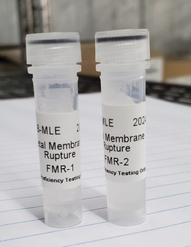 Amnisure Test: Accuracy, Procedure, and What Expecting Mothers Should Know