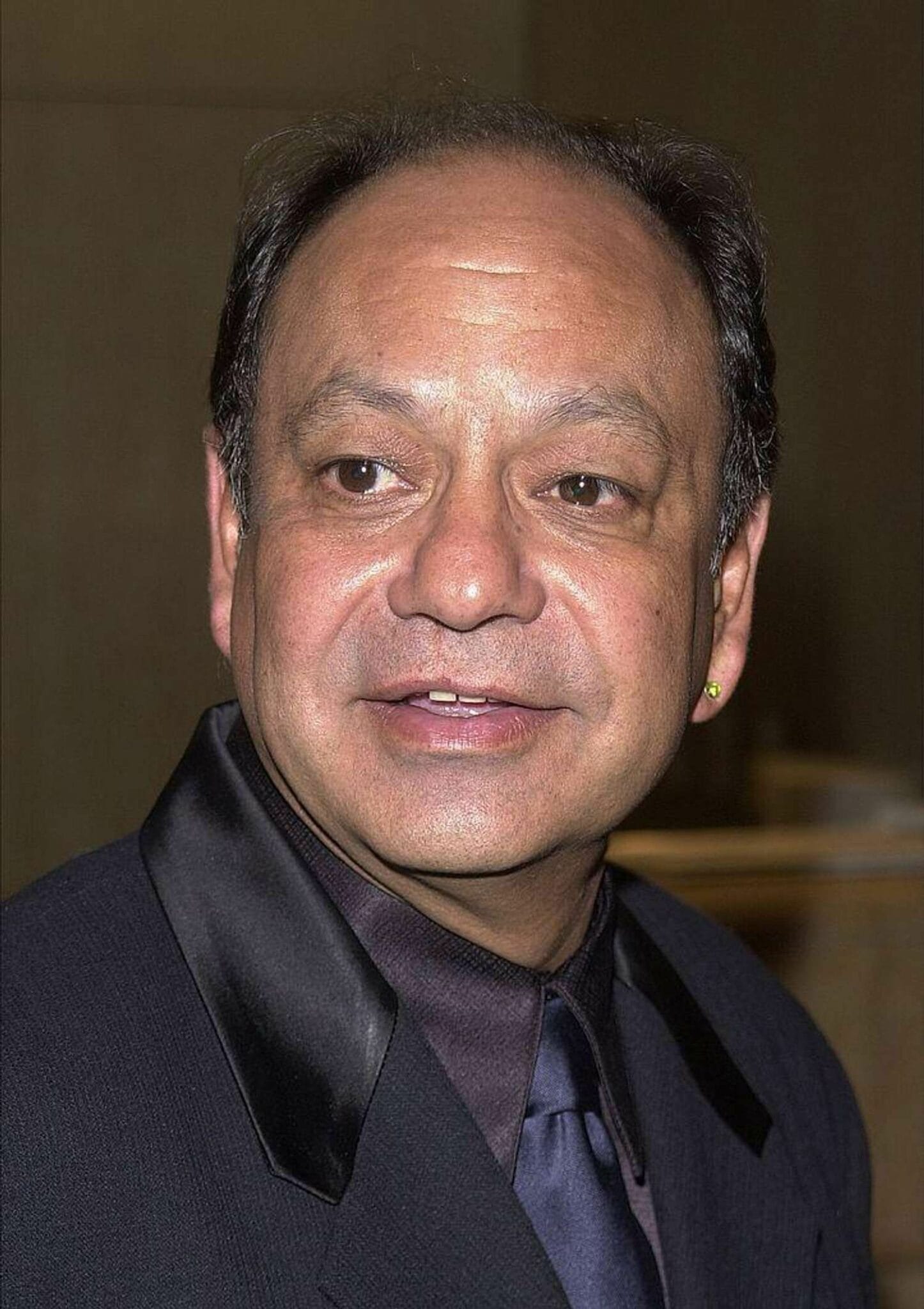 Beyond the Scar: Celebrities with Cleft Lip and Palate Who Inspire