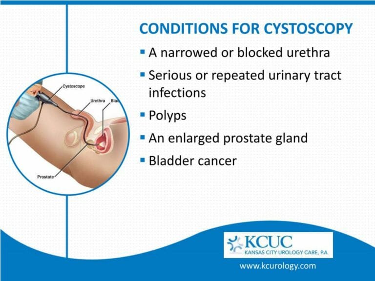 2024 Cystoscopy CPT Codes: A Complete Guide to Accurate Billing and ...