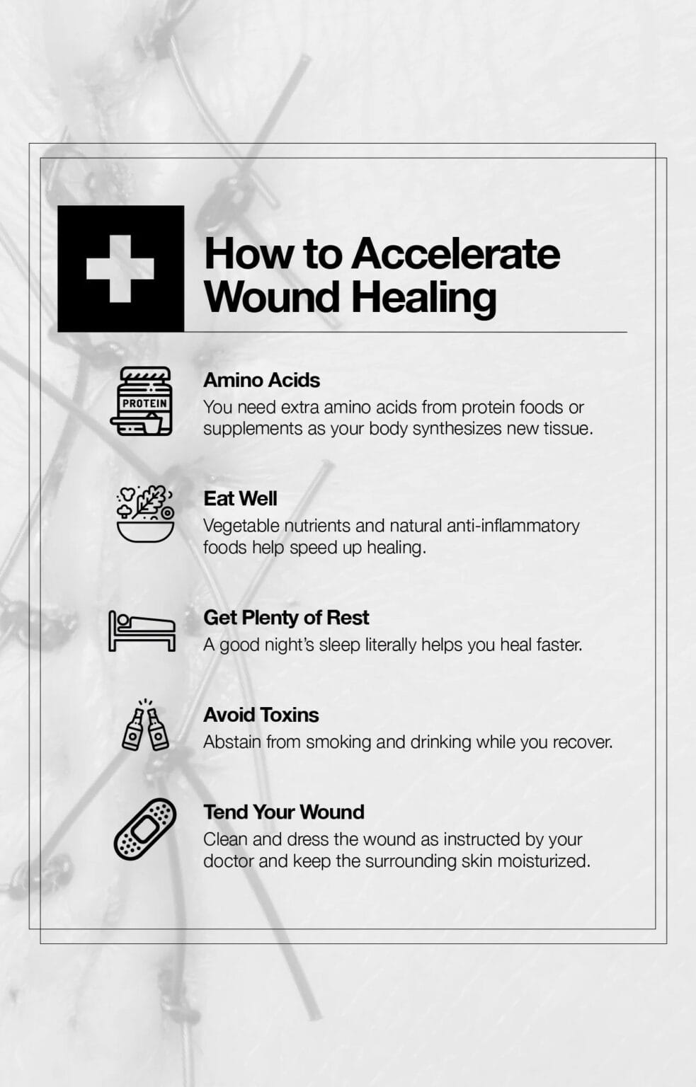 How Long Do Dissolving Stitches Last in Your Mouth? A Guide to Healing ...