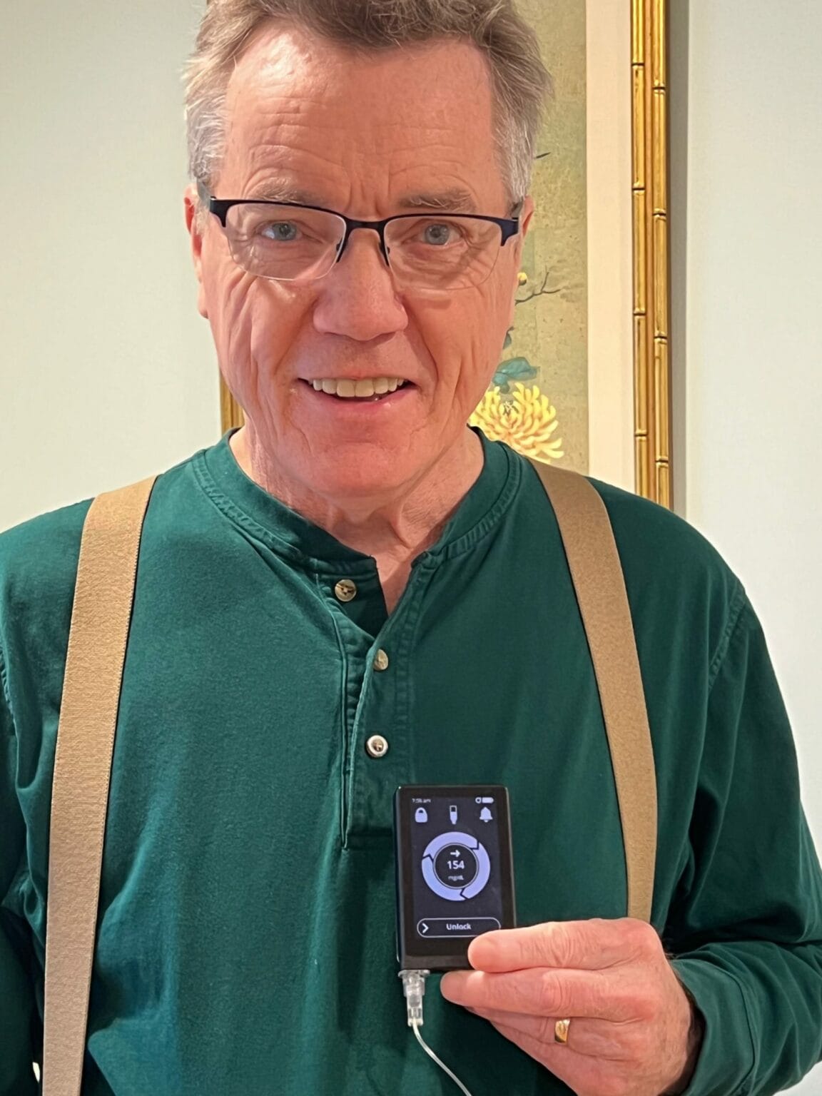 iLet Bionic Pancreas: A Comprehensive Guide to Automated Insulin Delivery