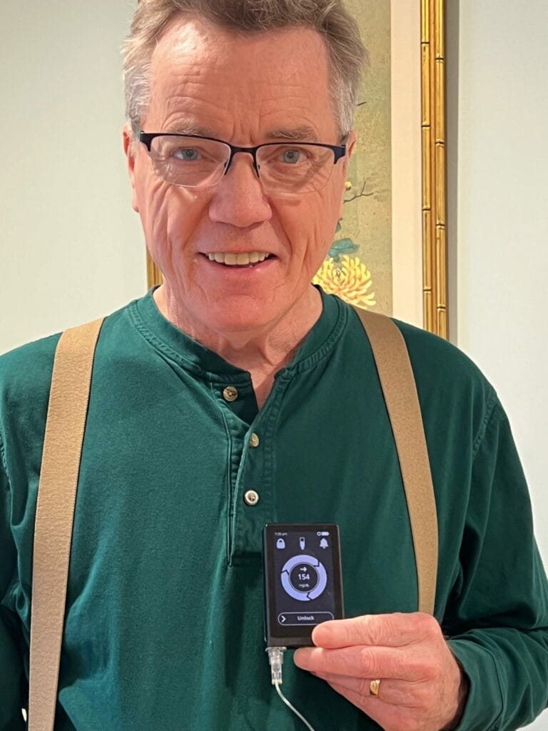 iLet Bionic Pancreas: A Comprehensive Guide to Automated Insulin Delivery