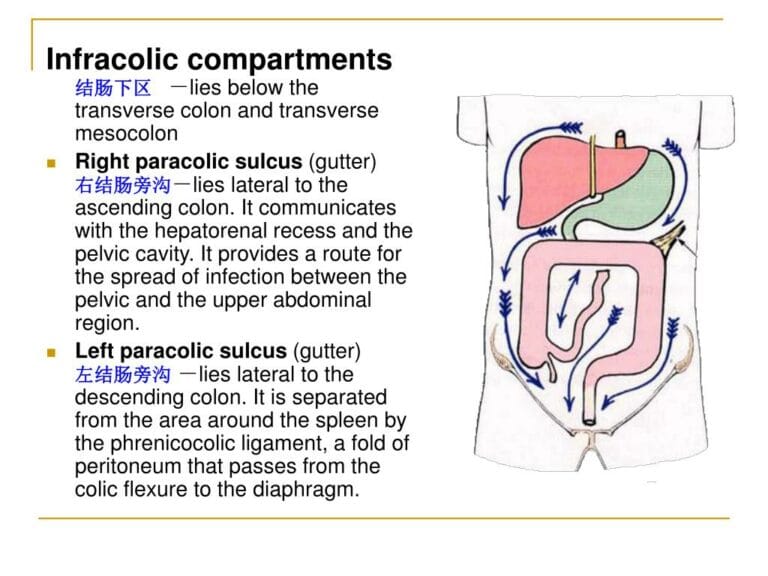 Paracolic Gutters: Anatomy, Clinical Significance, and Surgical ...