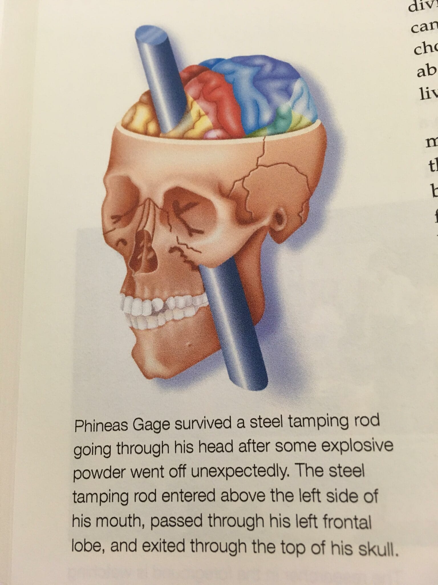 The Best Phineas Gage Books: Unraveling the Man, the Myth, and the Brain