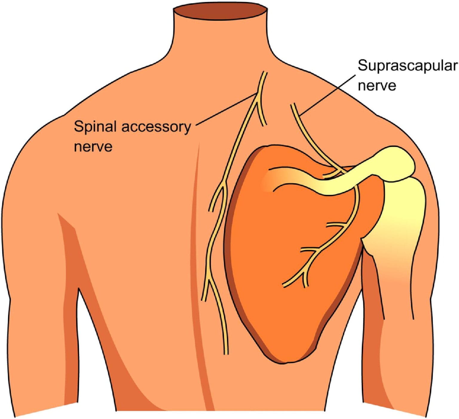 Dorsal Scapular Nerve Entrapment: A Guide to Symptoms, Diagnosis, and ...
