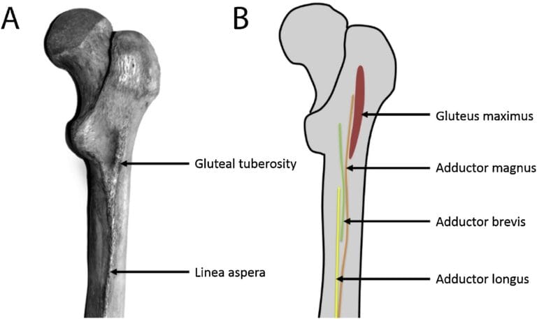 Decoding the Linea Aspera: A Comprehensive Guide to Femur Anatomy and ...