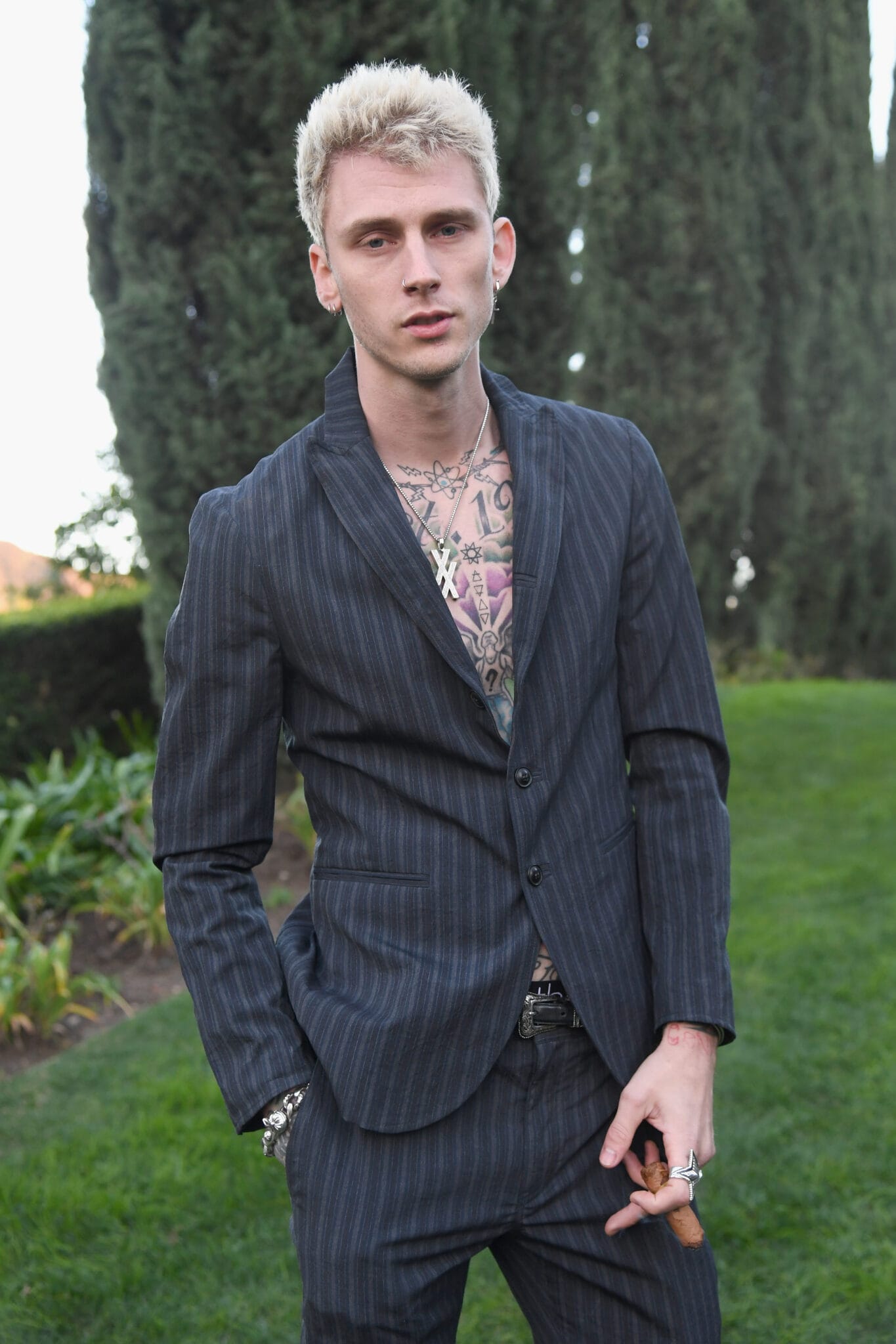 Did Machine Gun Kelly Get a Hair Transplant? Examining the Evidence