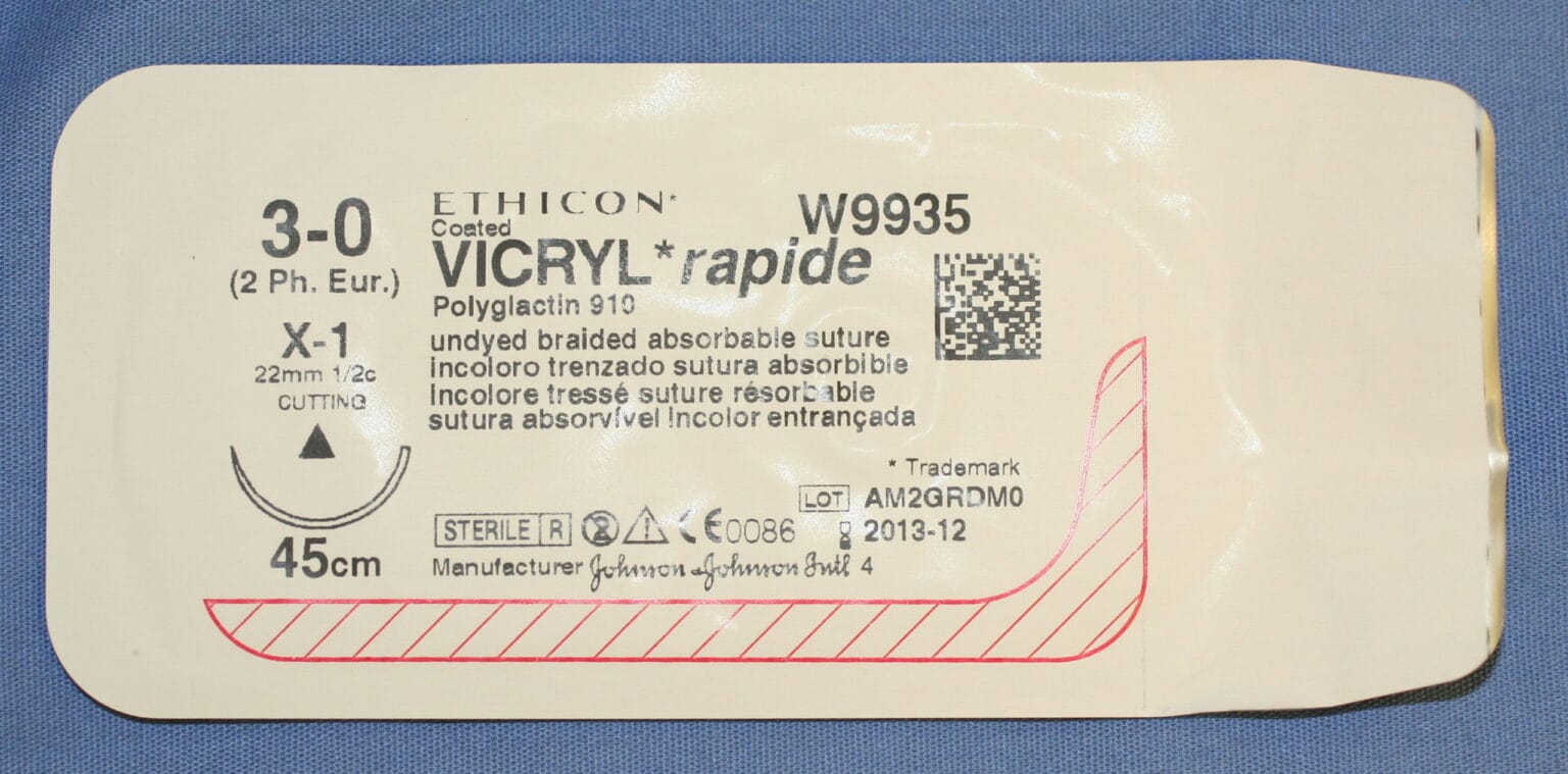 Operculectomy: A Complete Guide to Wisdom Tooth Gum Flap Removal & Recovery