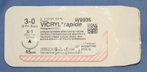 Operculectomy: A Complete Guide to Wisdom Tooth Gum Flap Removal & Recovery