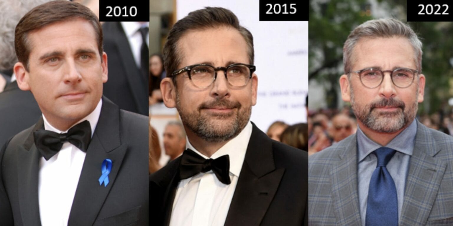Steve Carell's Hair Transformation: Did He Have a Transplant?